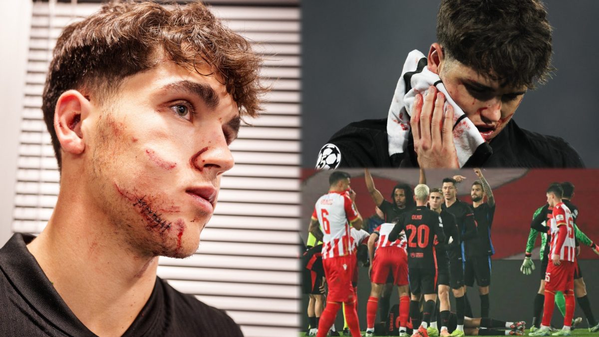 '10 stitches for Cubarsi' - Pau Cubarsi Injury Update following Big UCL ...